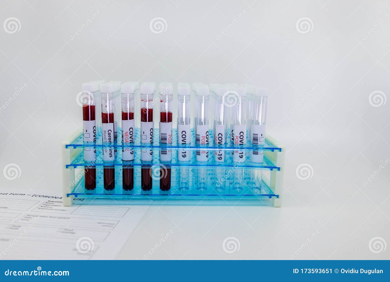 Test Tubes Rack With Blood Sample For Coronavirus, Covid-19 Virus And ...