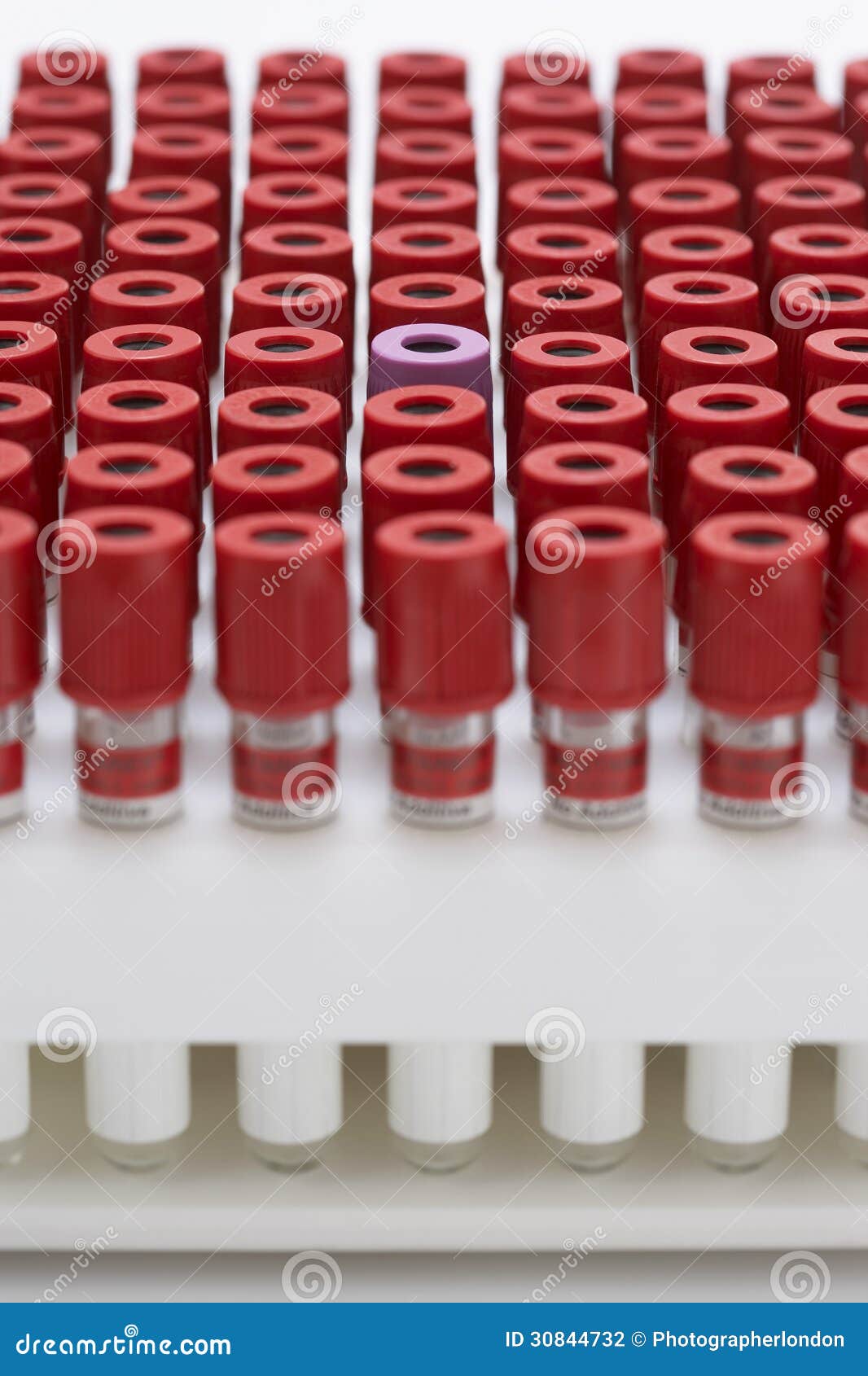 Test Tubes with Red Lids Surrounding One with Purple Lid Stock Photo ...