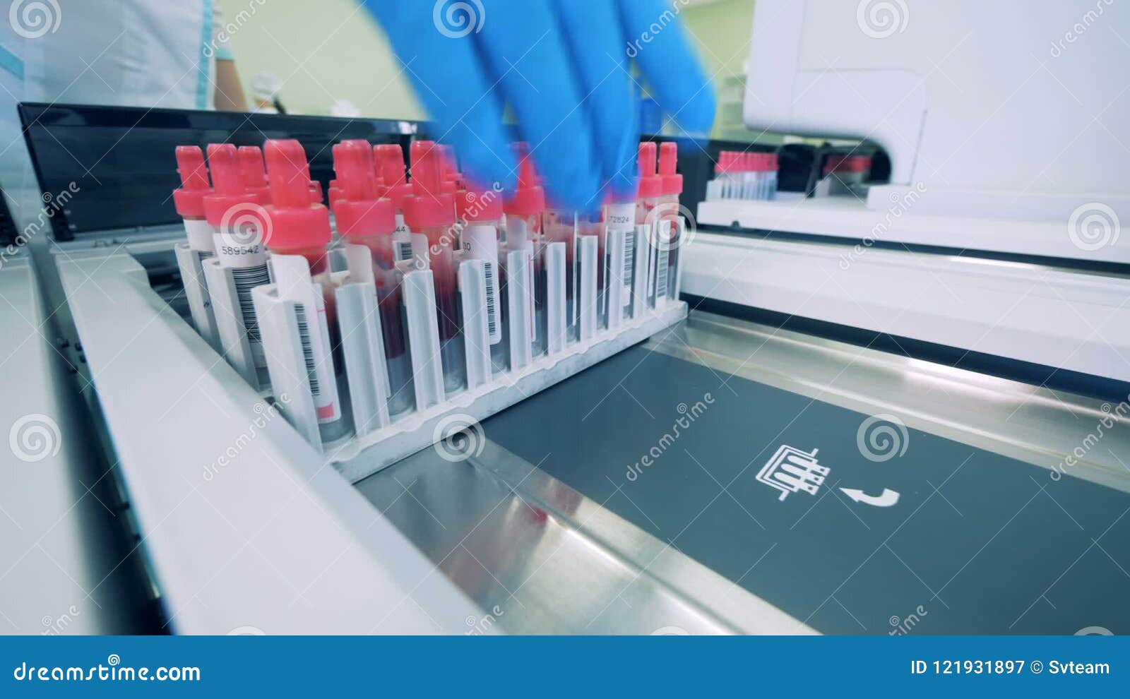 Test Tubes with Samples are Getting Put Onto Conveyor Belt Stock Video ...