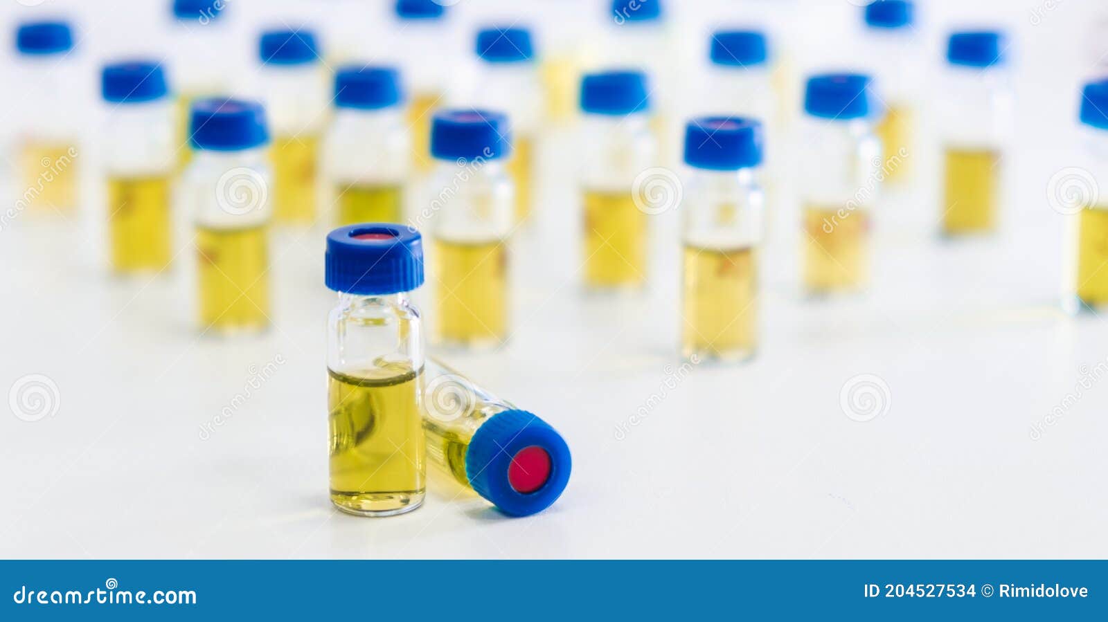 Test Tubes with Urine Sample for HPLC Analysis in the Laboratory Stock ...