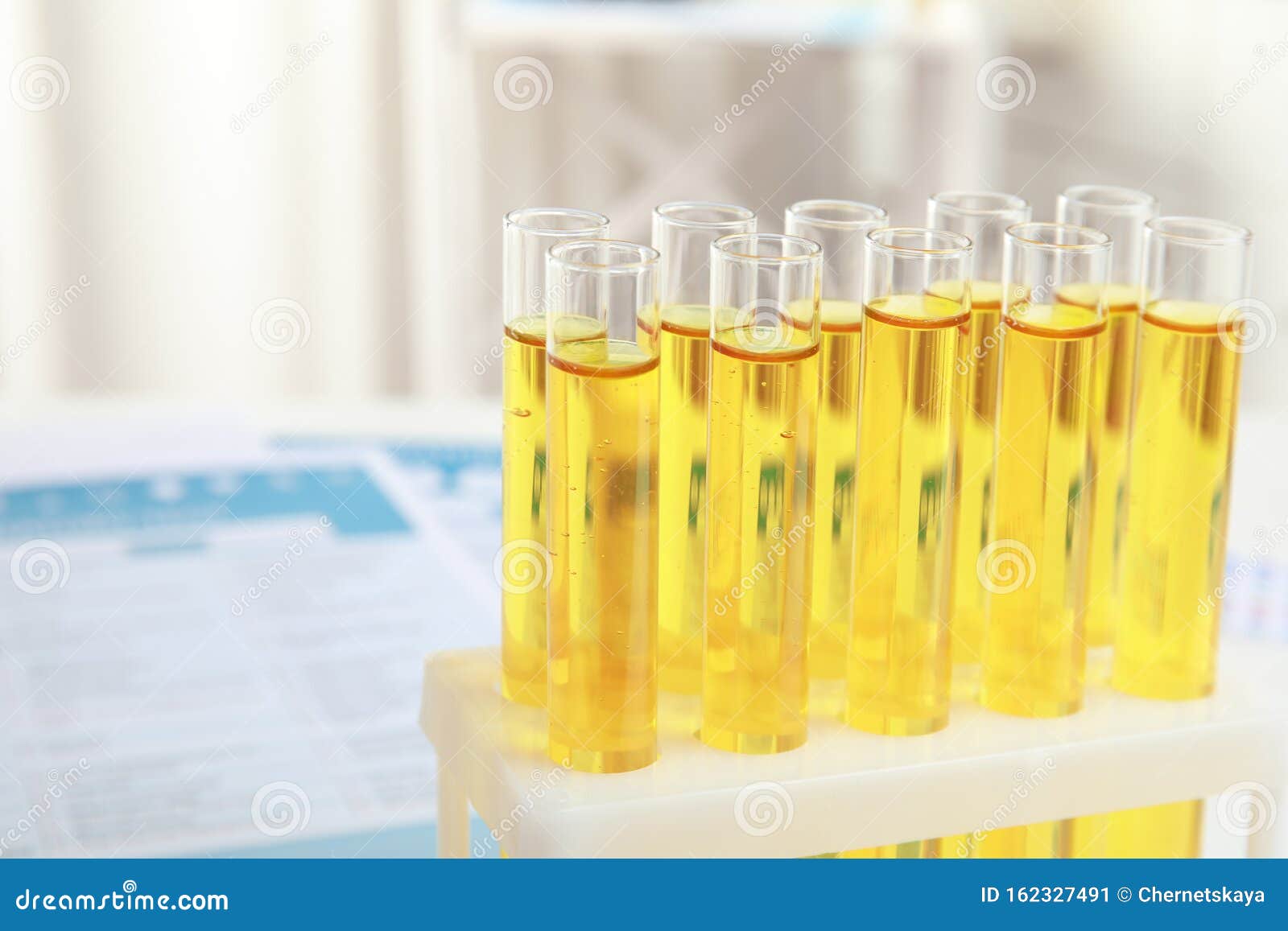 Urine Samples In The Laboratory In The Hospital Royalty-Free Stock ...