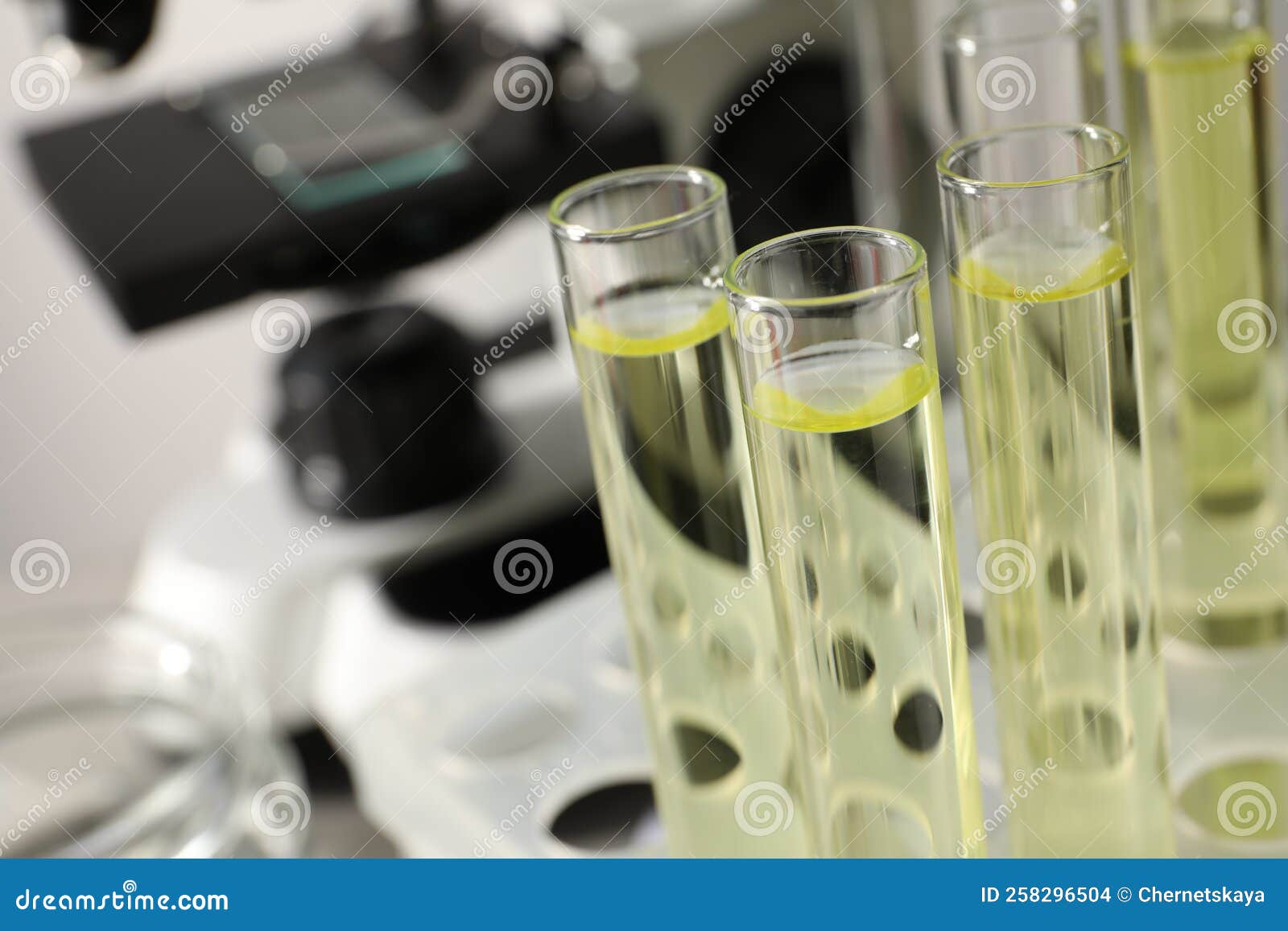 Test Tubes with Urine Samples for Analysis in Holder Near Microscope ...