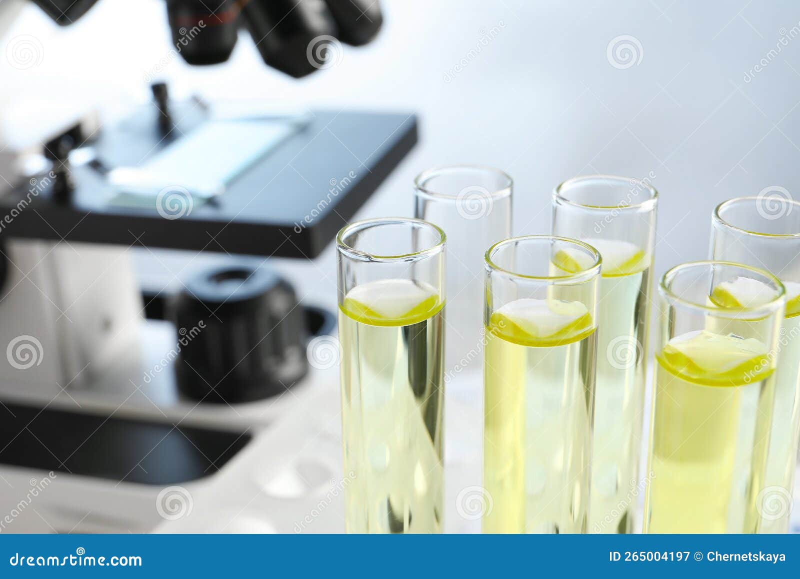 Test Tubes with Urine Samples for Analysis in Laboratory, Closeup Stock ...