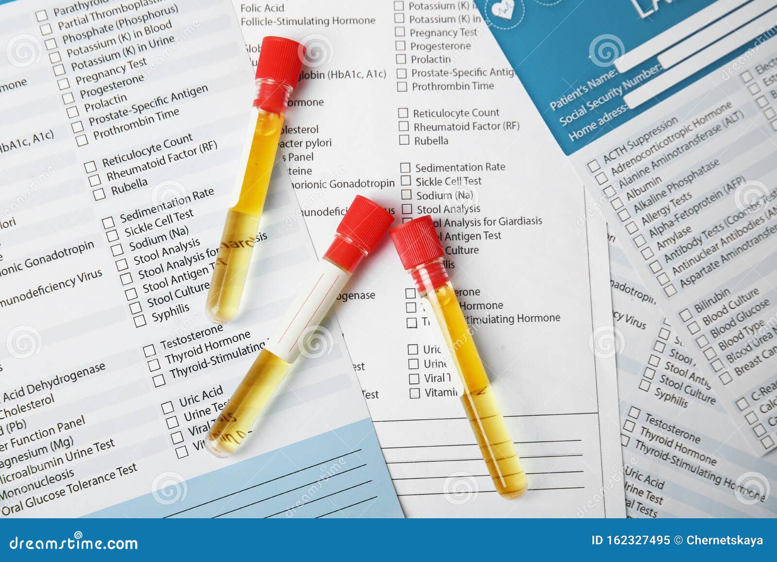 Test Tubes with Urine Samples for Analysis on Laboratory Test Form ...
