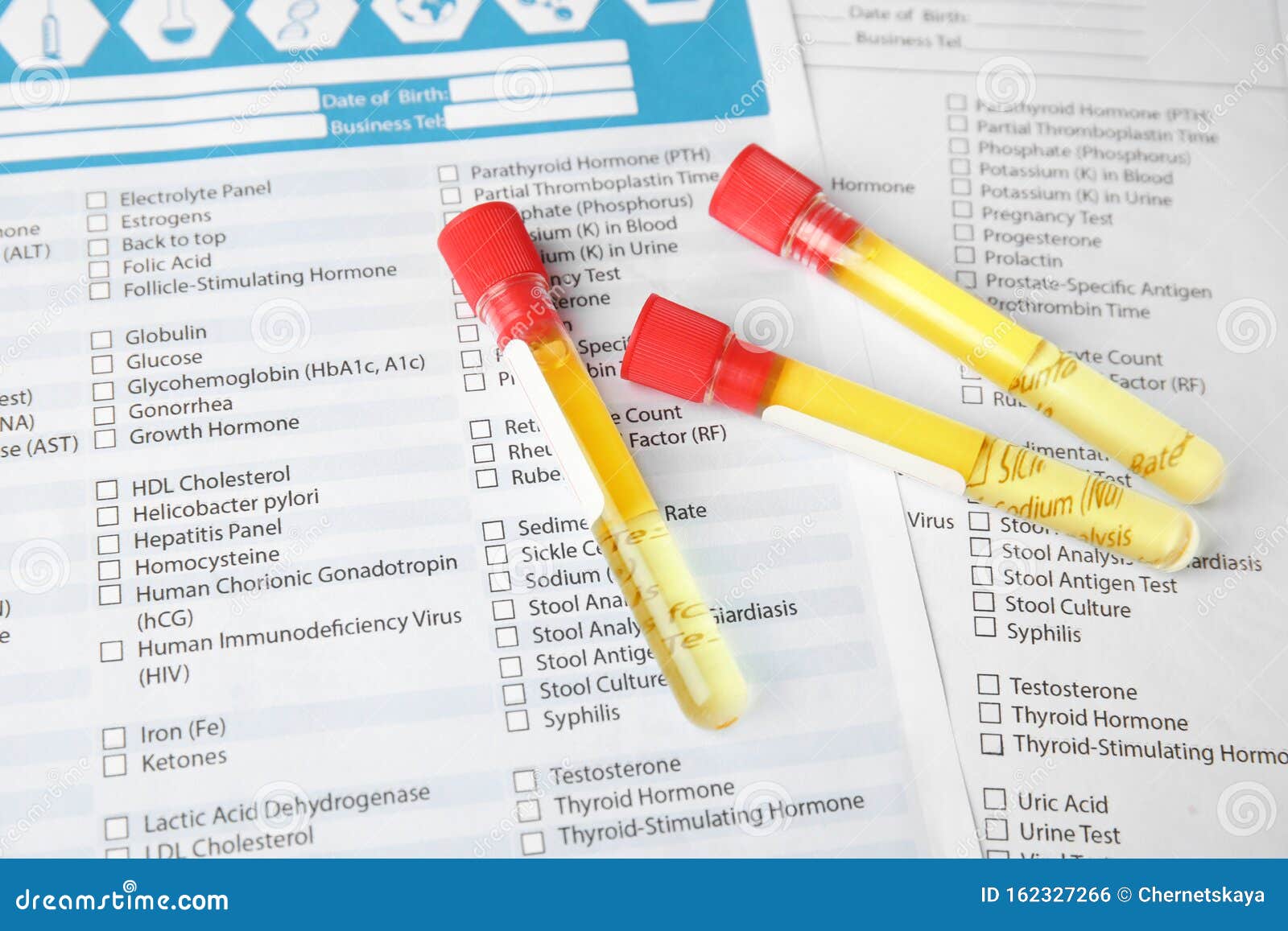 Test Tubes with Urine Samples for Analysis on Laboratory Test Stock ...