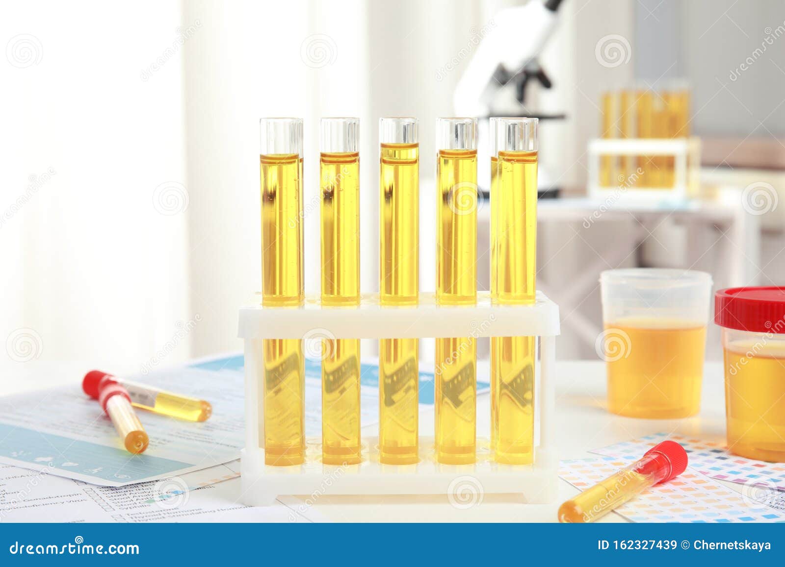 Test Tubes with Urine Samples for Analysis on White in Laboratory Stock ...