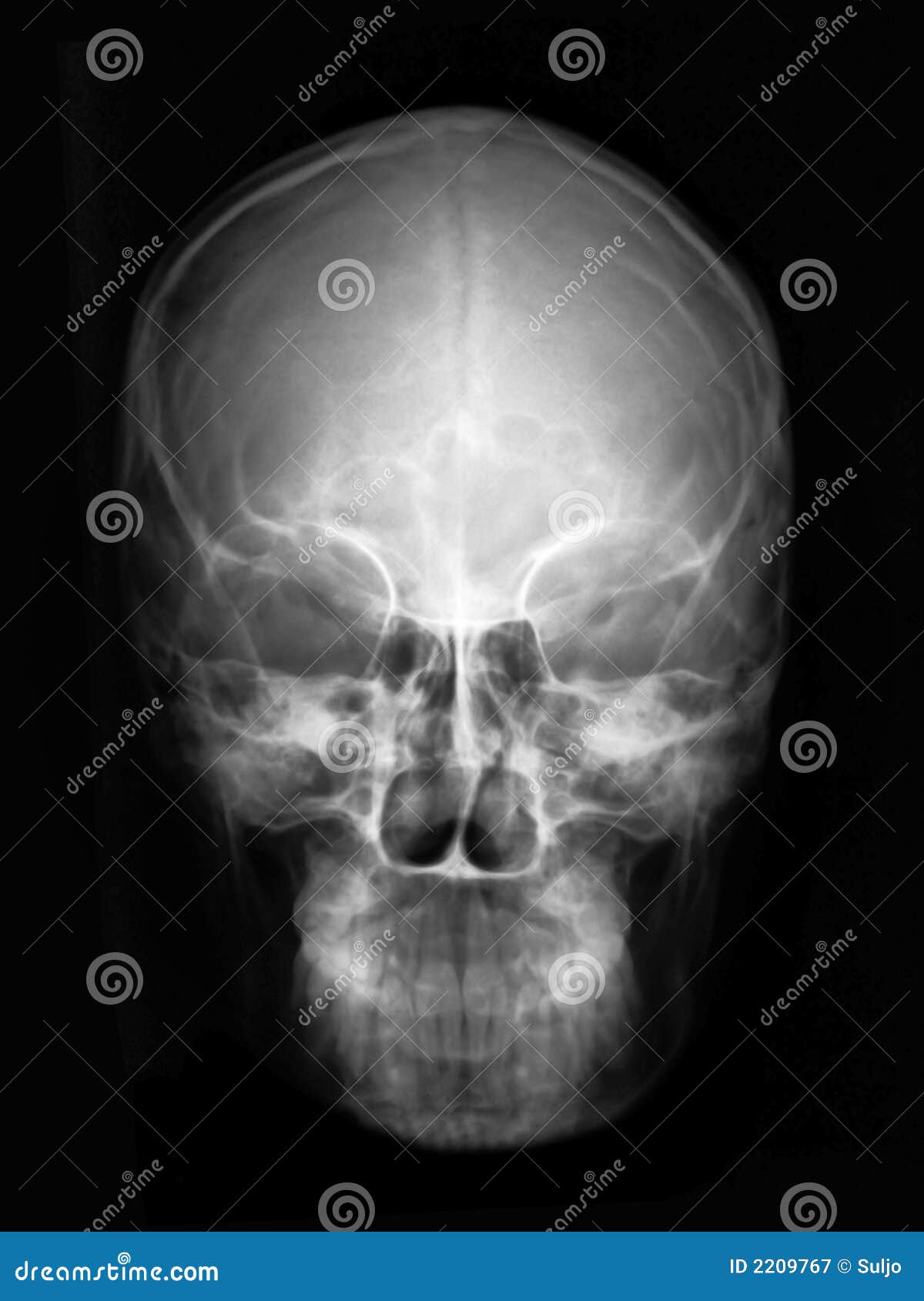 Testa immagine stock. Immagine di formazione, radiogramma - 2209767