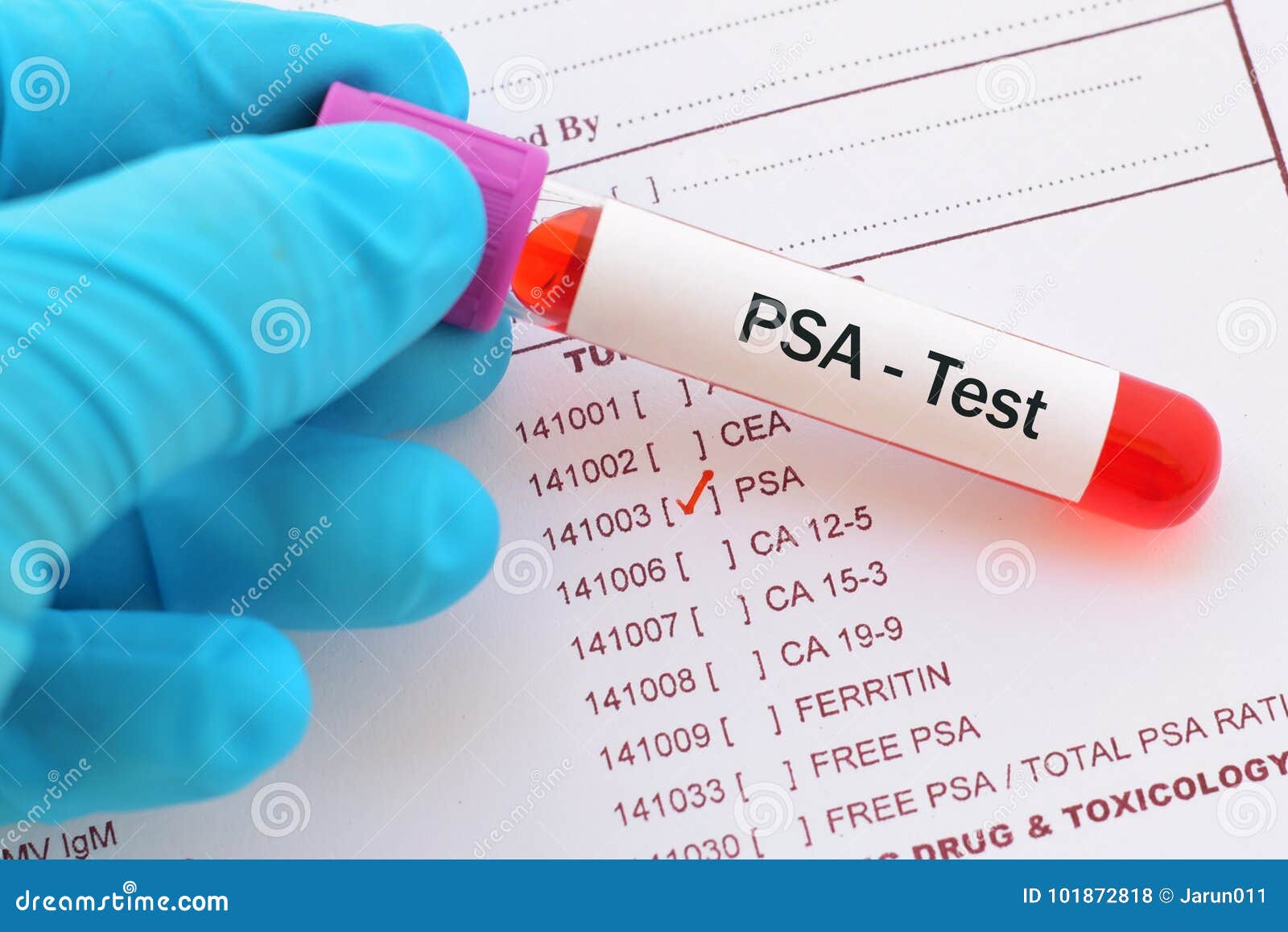 Teste da PSA foto de stock. Imagem de exame, paciente - 101872818