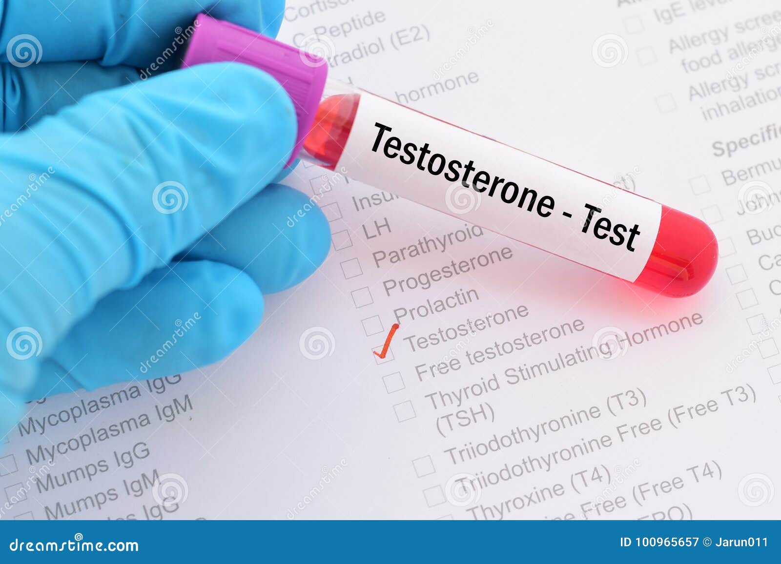 Teste da testosterona imagem de stock. Imagem de depoimento - 100965657