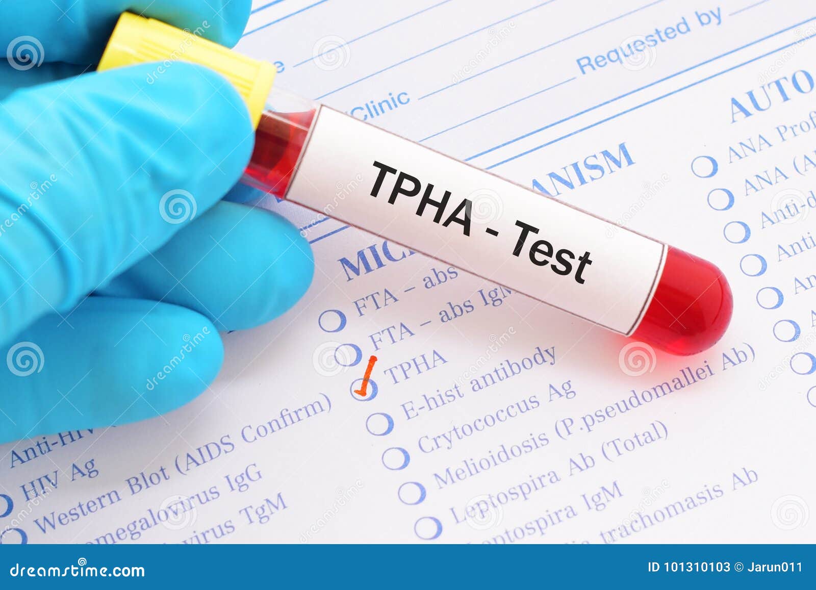 Teste de TPHA imagem de stock. Imagem de pesquisa, organismo - 101310103