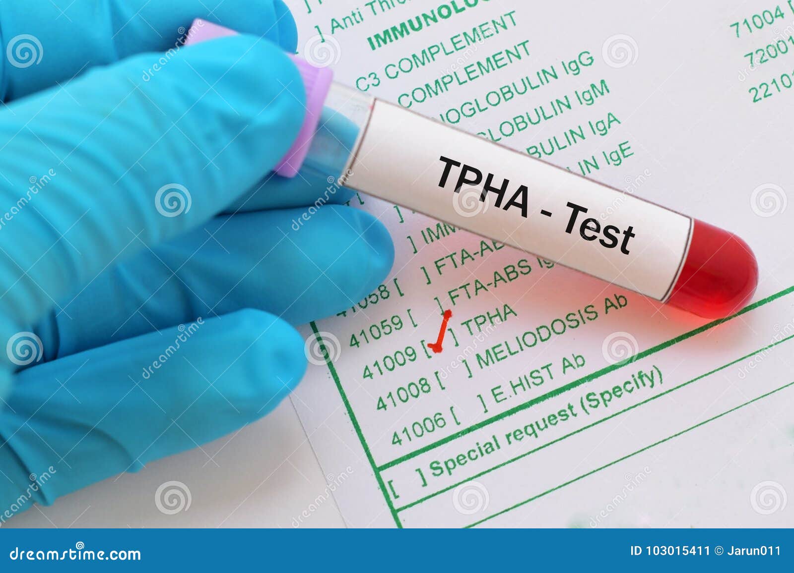 Teste de TPHA imagem de stock. Imagem de paciente, ciência - 103015411