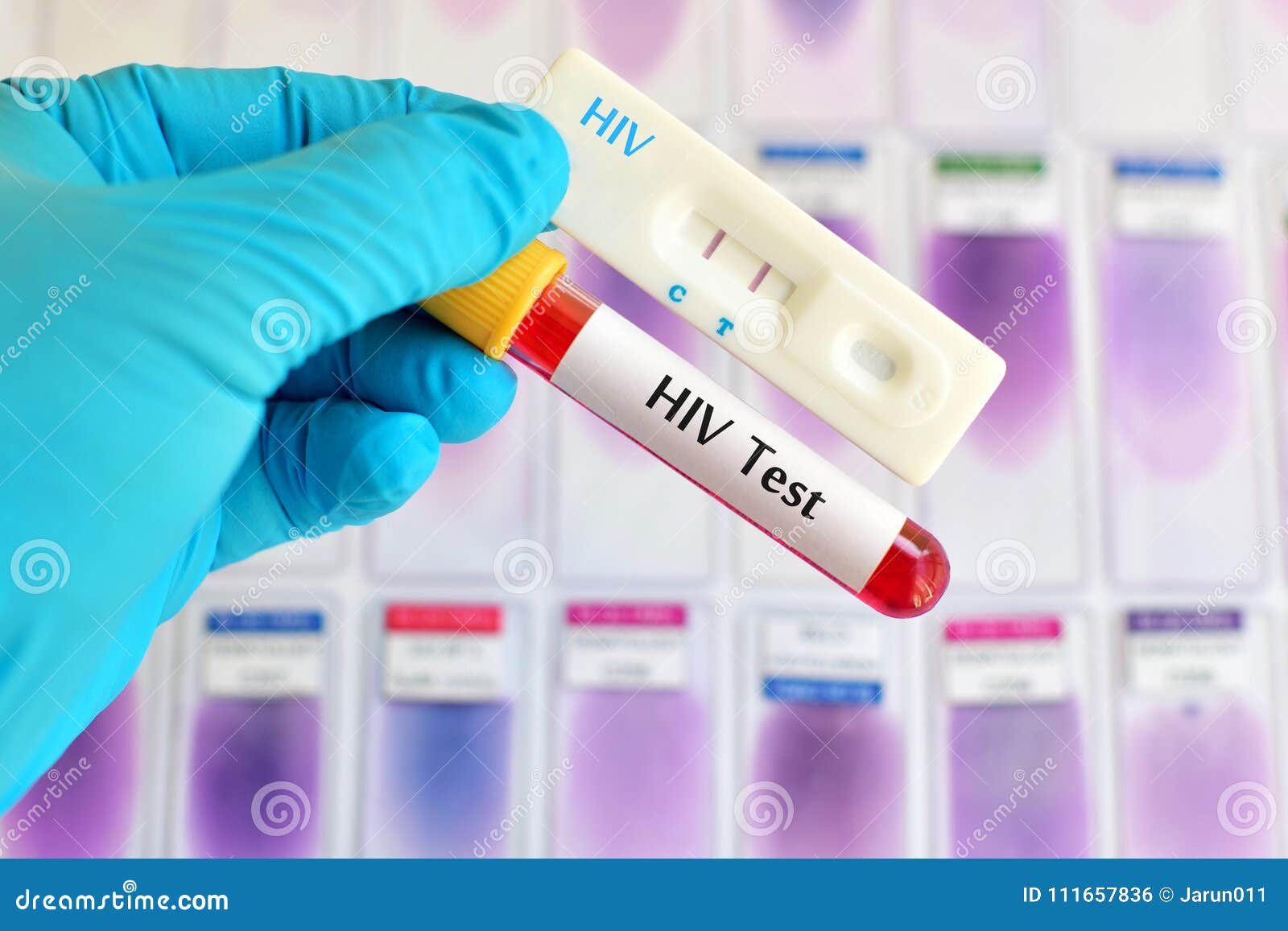 Testes do VIH foto de stock. Imagem de banco, imunologia - 111657836