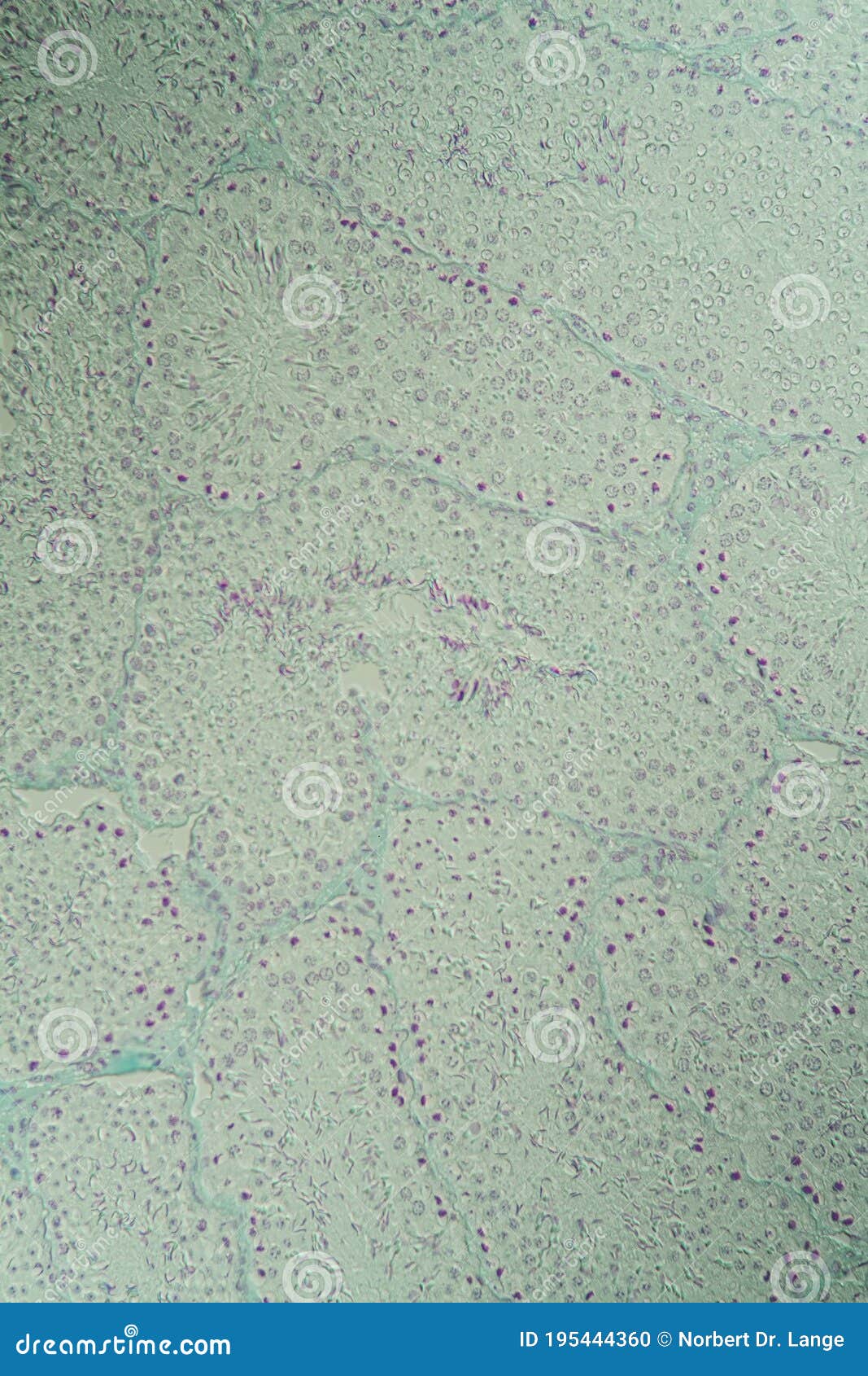Testicle Cross-section Under the Microscope Stock Photo - Image of ...