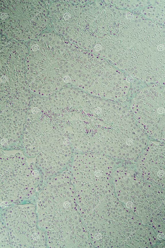 Testicle Cross-section Under the Microscope Stock Photo - Image of ...