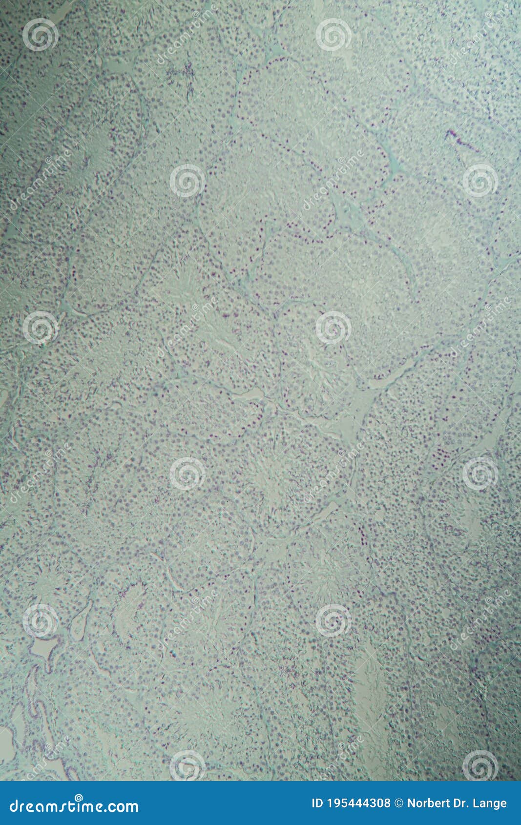 Testicle Cross-section Under the Microscope Stock Photo - Image of ...