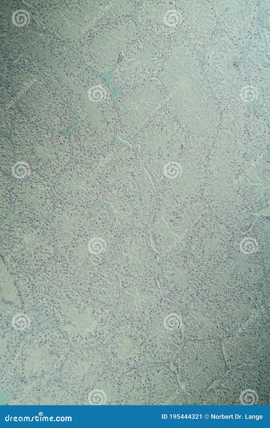 Testicle Cross-section Under the Microscope Stock Image - Image of ...