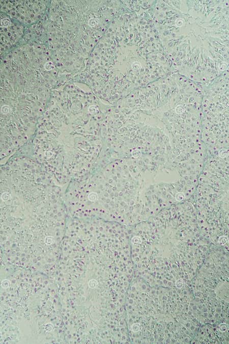 Testicle Cross-section Under the Microscope Stock Image - Image of 100x ...