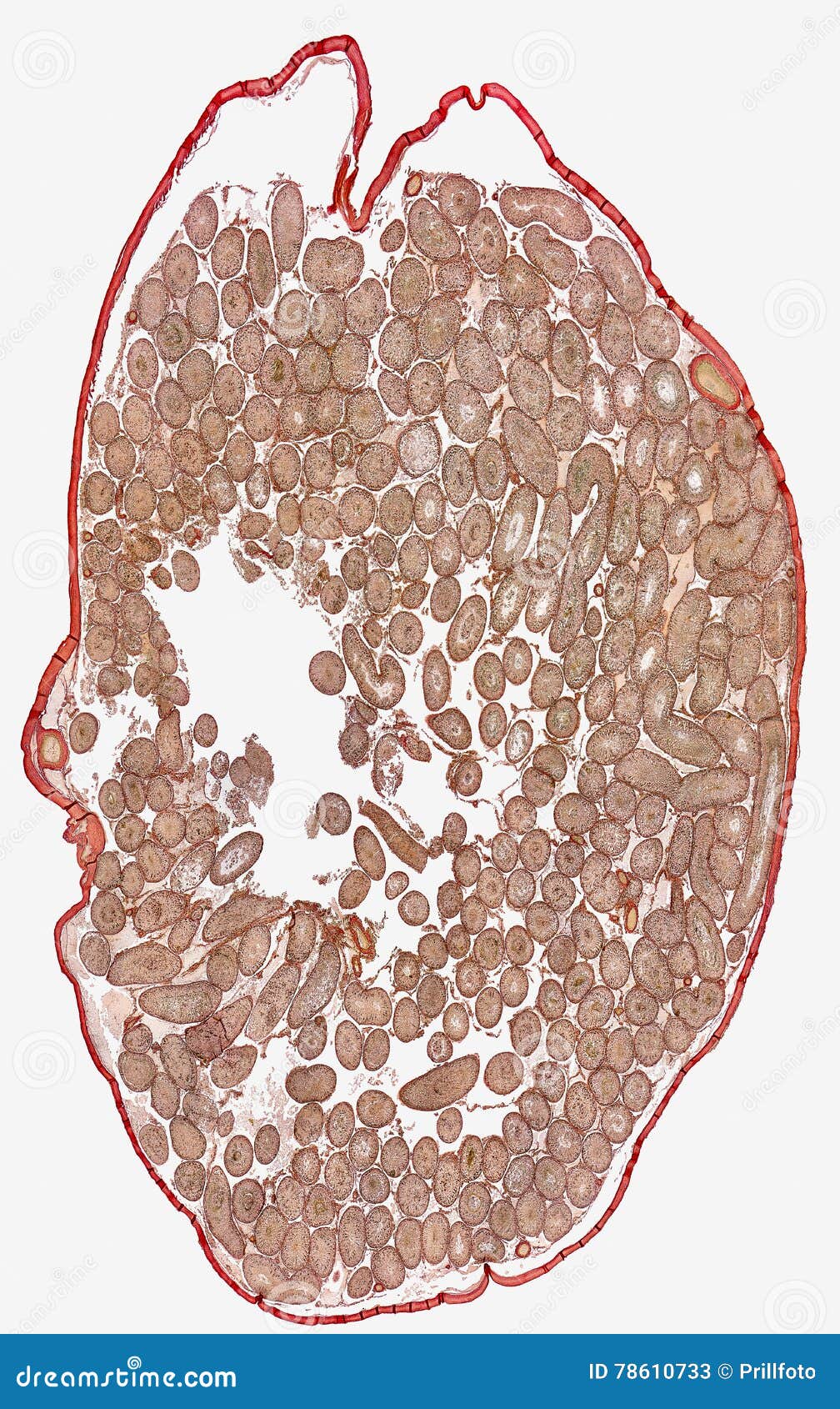 Testicle macro stock image. Image of microscopic, testicle - 78610733