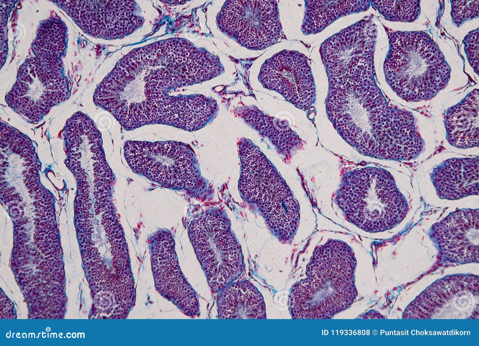 Testicule Humain Sous La Vue De Microscope Photo stock - Image du ...