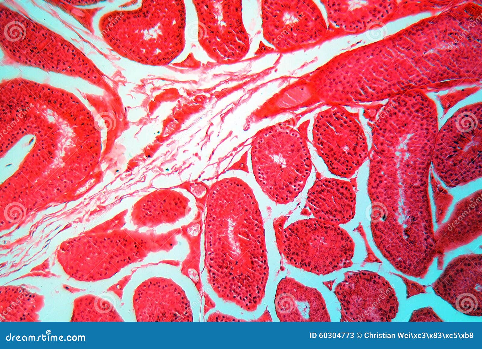 Testikel-Zellen Unter Dem Mikroskop Stockbild - Bild von menschlich ...