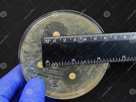Antimicrobial Antibiotic Resistance Disc Test Interpretation Measuring ...