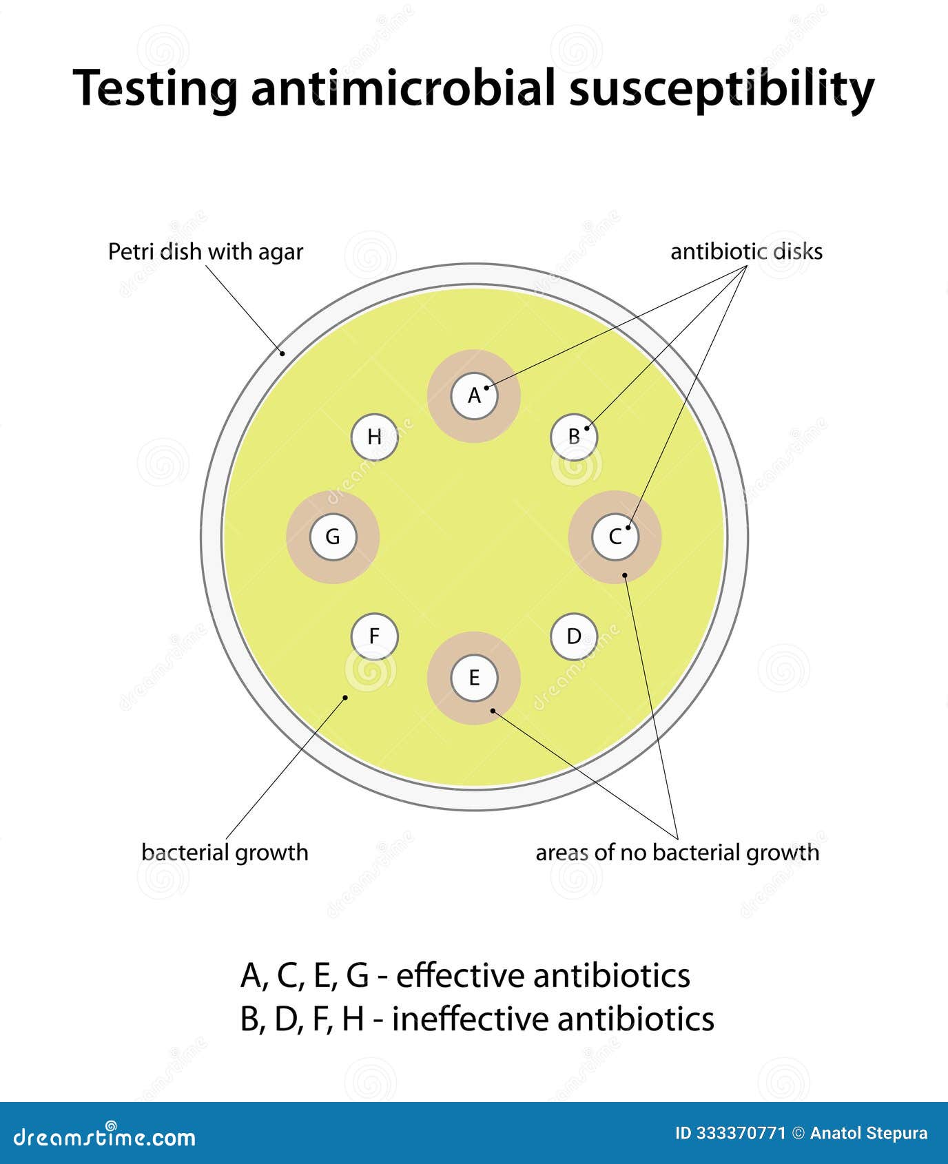 Testing Antimicrobial Susceptibility (disk Diffusion Test). Stock ...