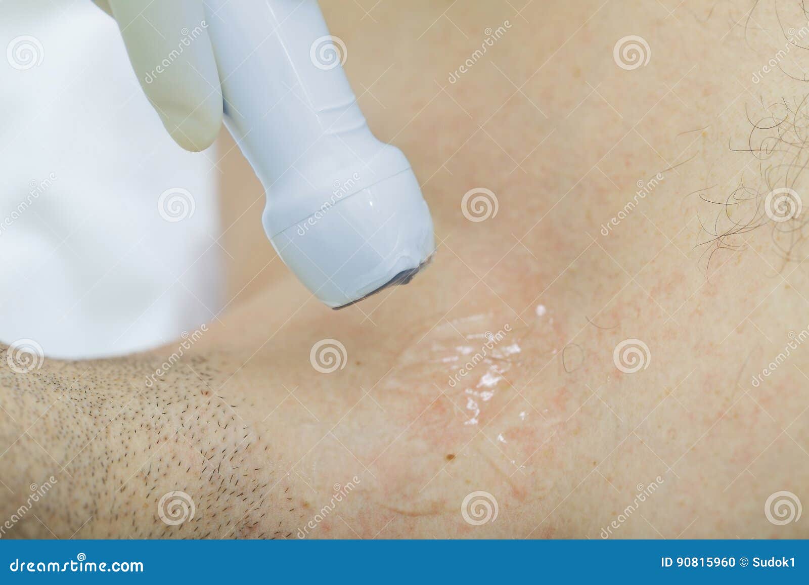 Testing Neck Organs with Ultrasonic Examination Stock Photo - Image of ...