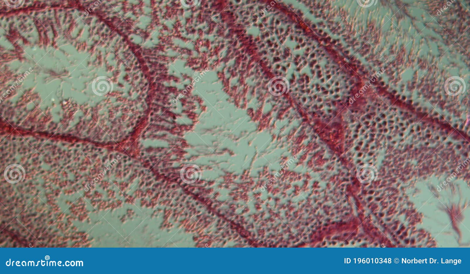 Testis of the Rat in Cross Section Stock Footage - Video of diagnose ...