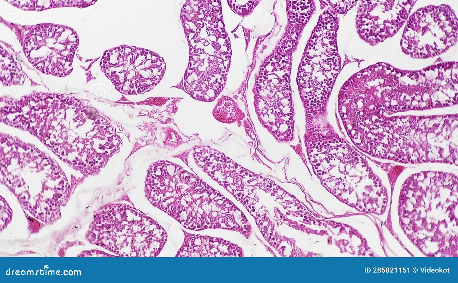 Testis in Section of Human Being at Scientific Slide Magnified Under ...