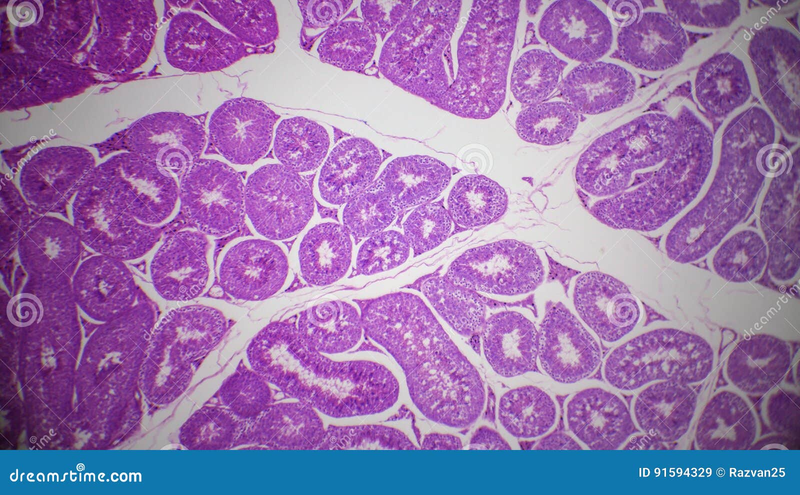 Testis Section Under the Microscope Stock Image - Image of biopsy ...