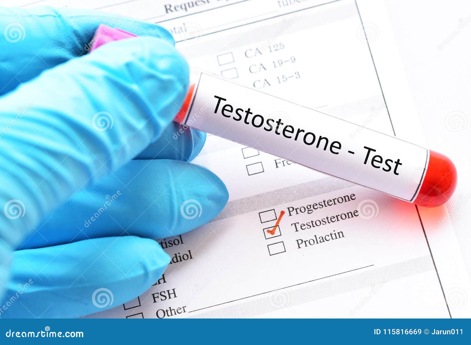 Testosterone hormone test stock image. Image of penis - 115816669