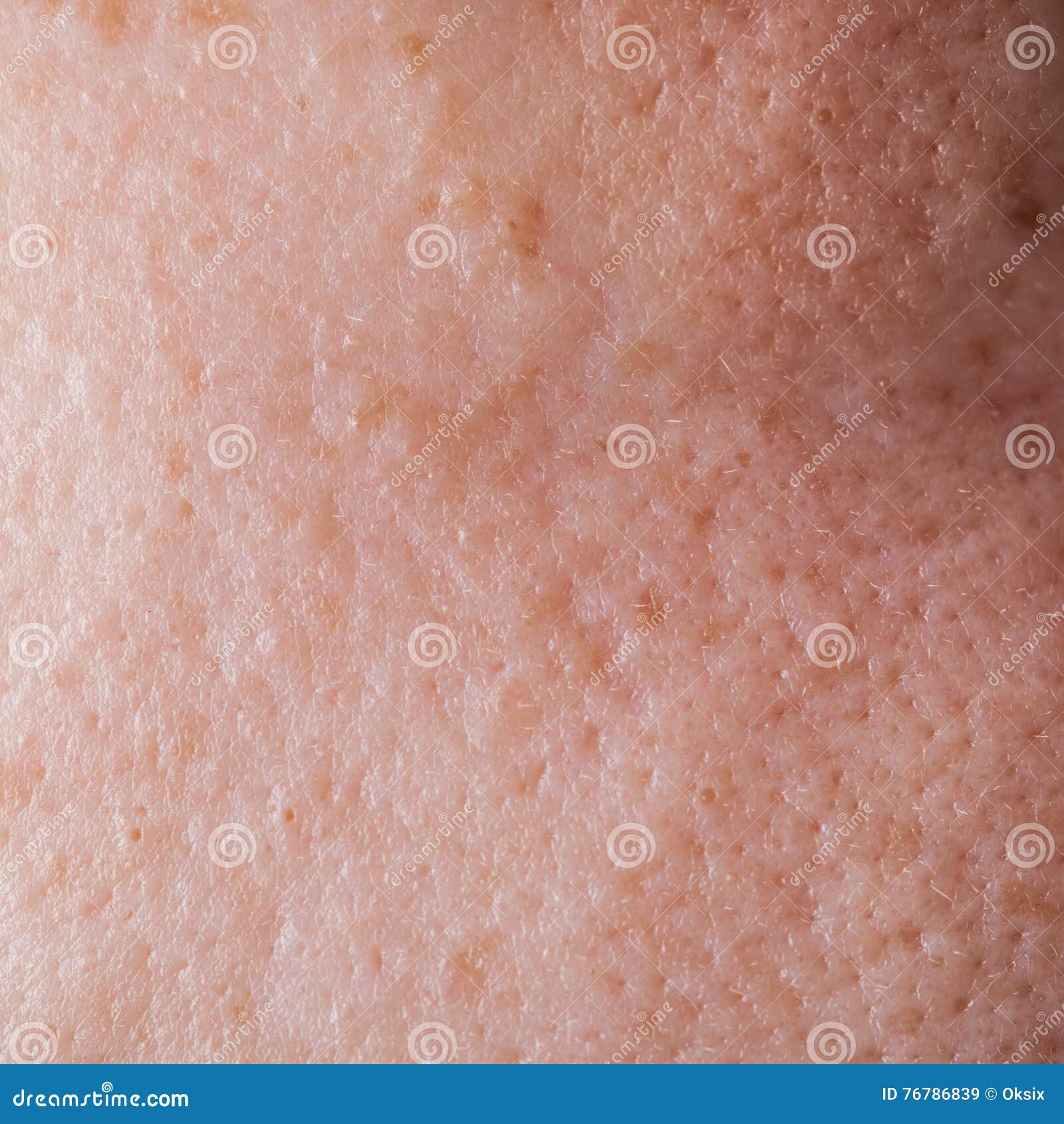 Textura De La Piel Del Rostro Humano Imagen de archivo - Imagen de ...