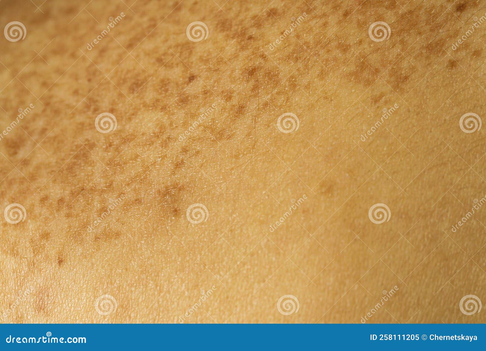 Texture of Human Skin As Background, Closeup View Stock Image - Image ...