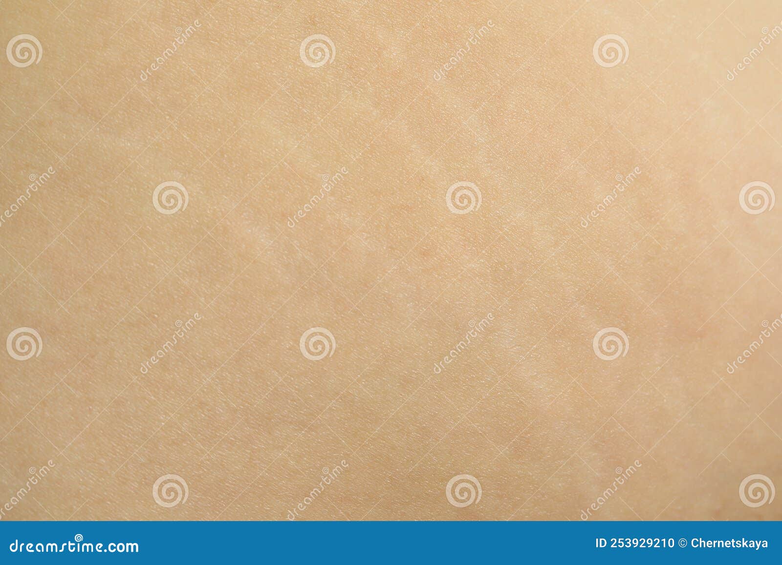 Stretch On Human Skin Background Stock Image | CartoonDealer.com #223616617