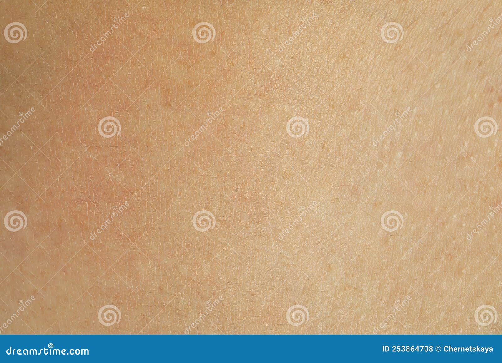 Texture of Human Skin with Birthmarks, Closeup View Stock Photo - Image ...