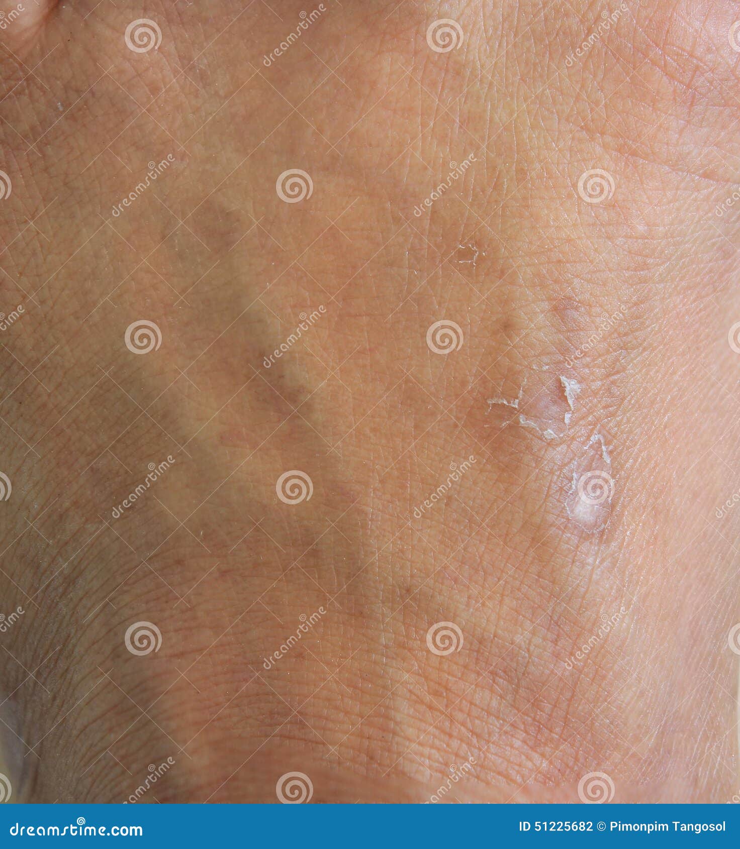 Texture of human skin stock photo. Image of hand, body - 51225682