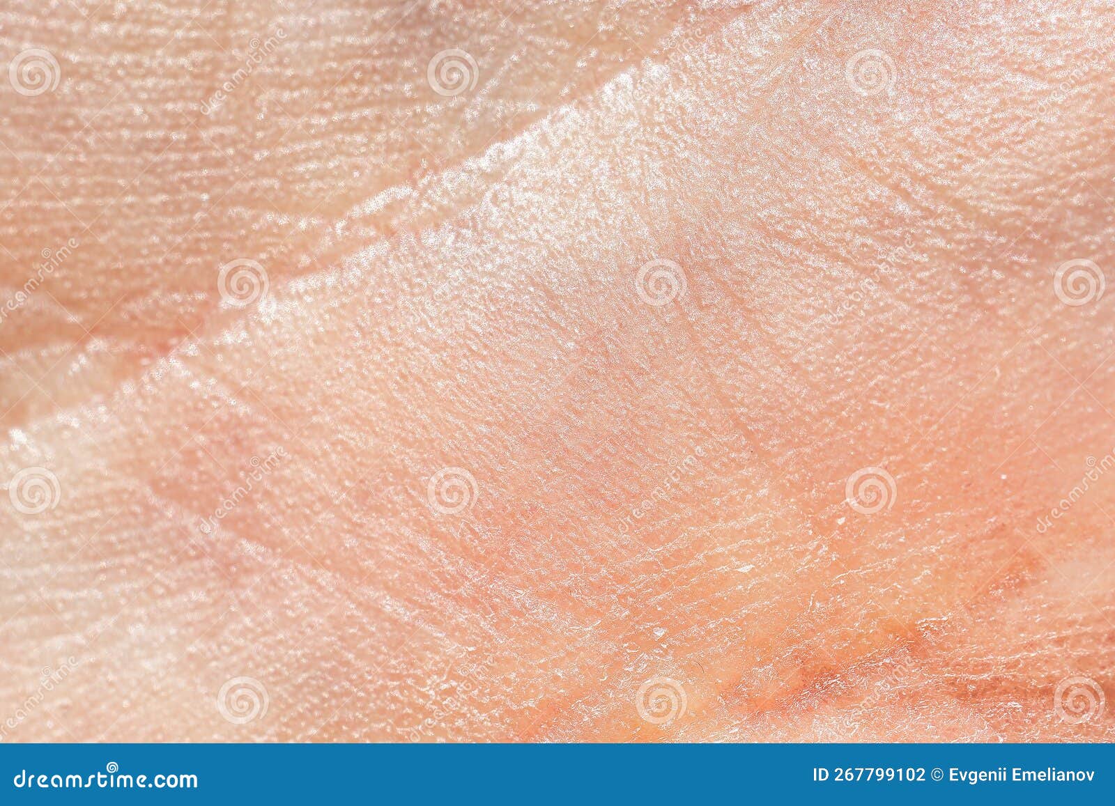 The Texture of the Skin of the Hand. Stock Photo - Image of male ...
