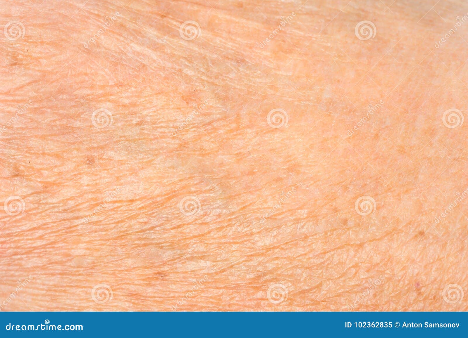 Texture of the skin stock image. Image of dermatology - 102362835