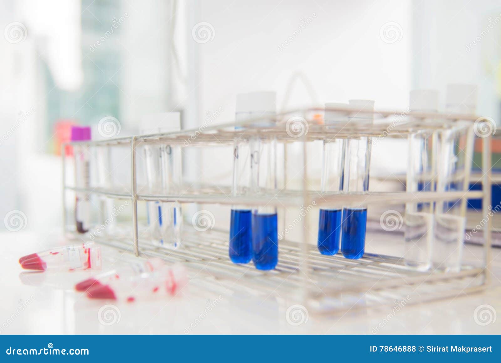 Thalassemia Screening Test. Stock Photo - Image of blurred, donor: 78646888