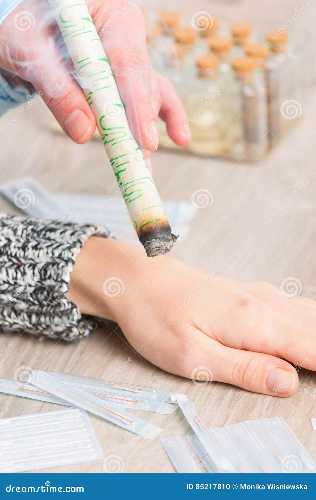 Therapist Doing Moxa Treatment Stock Photo - Image of medicine, care ...