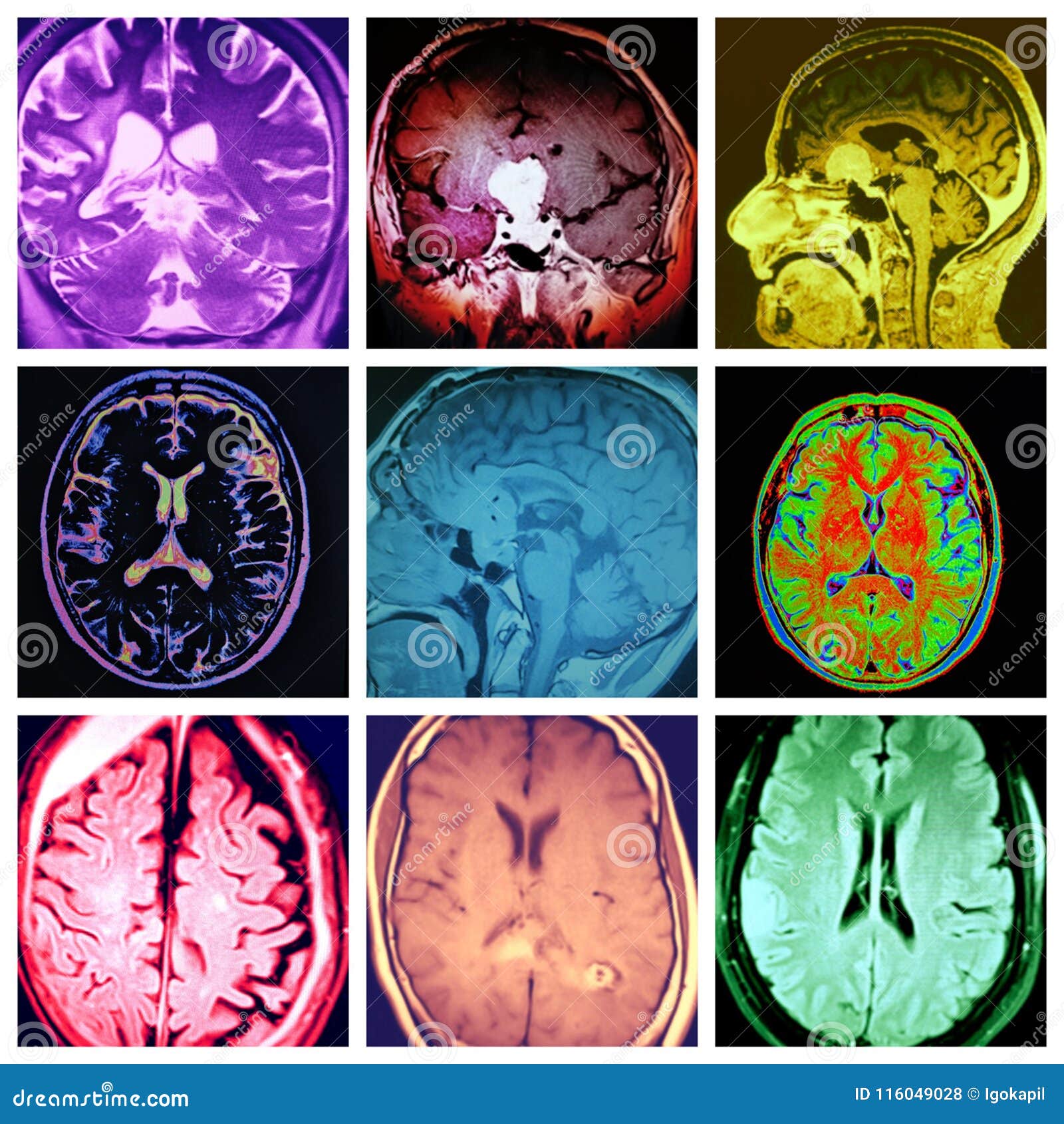 Brain Different Pathology Colorful Collage Stock Illustration ...