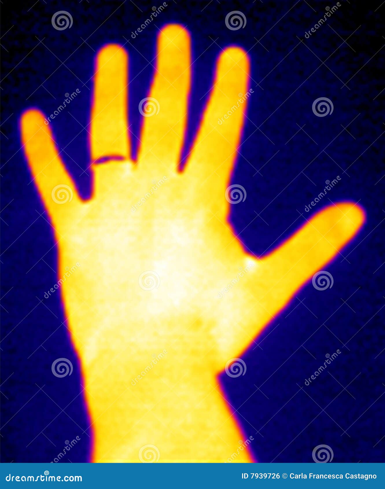 Thermographe-Main Et Boucle Photo stock - Image du lumière, intense ...