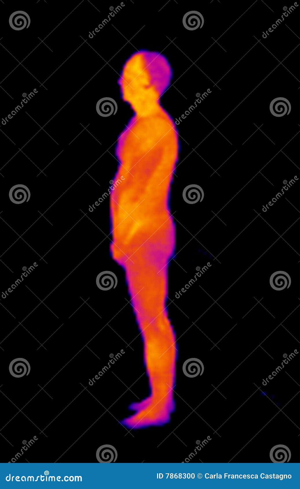 Thermographic image of man stock photo. Image of skin - 7868300