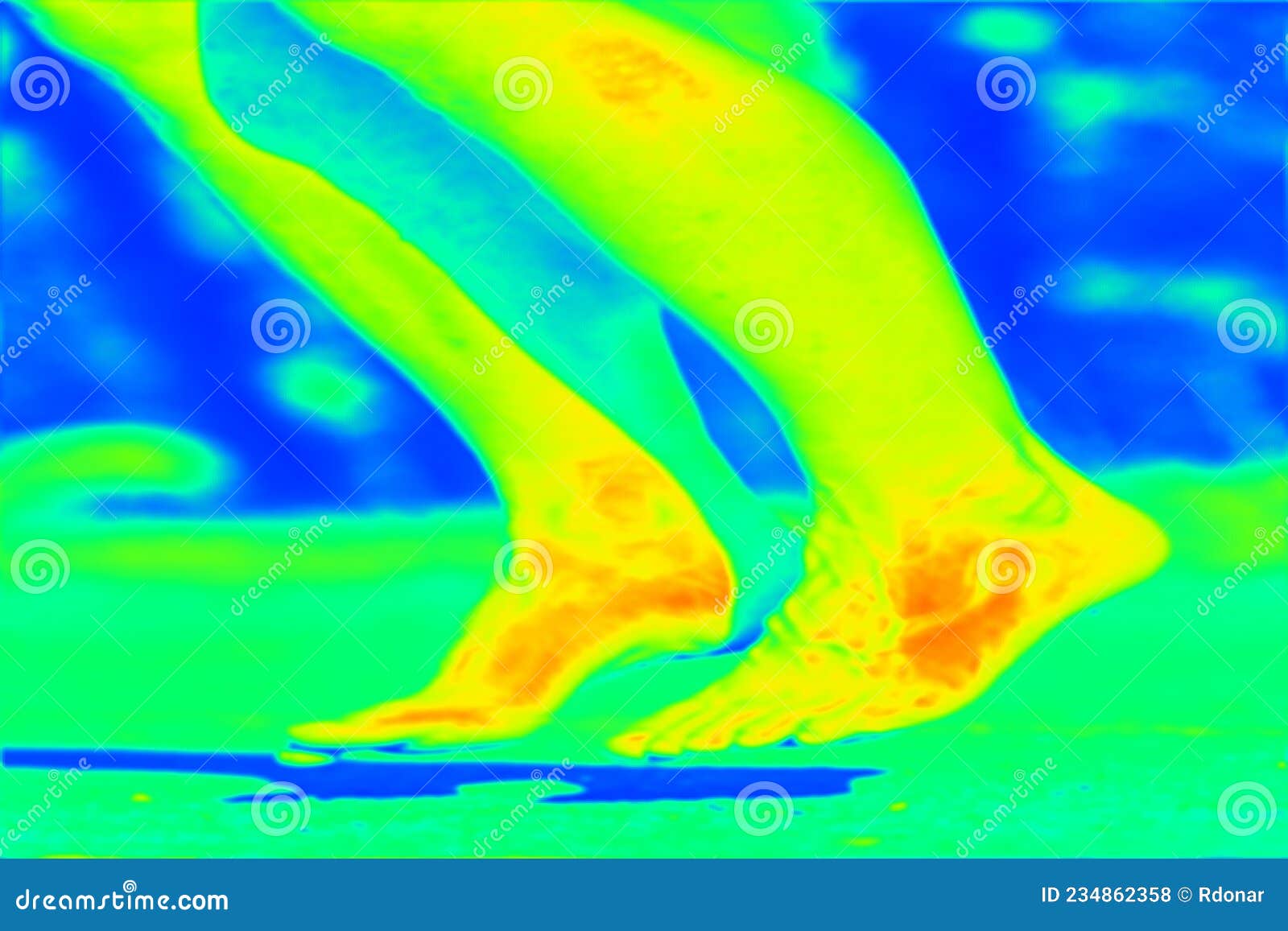 Thermographic Scan. Different Temperature in a Range of Colors Stock ...