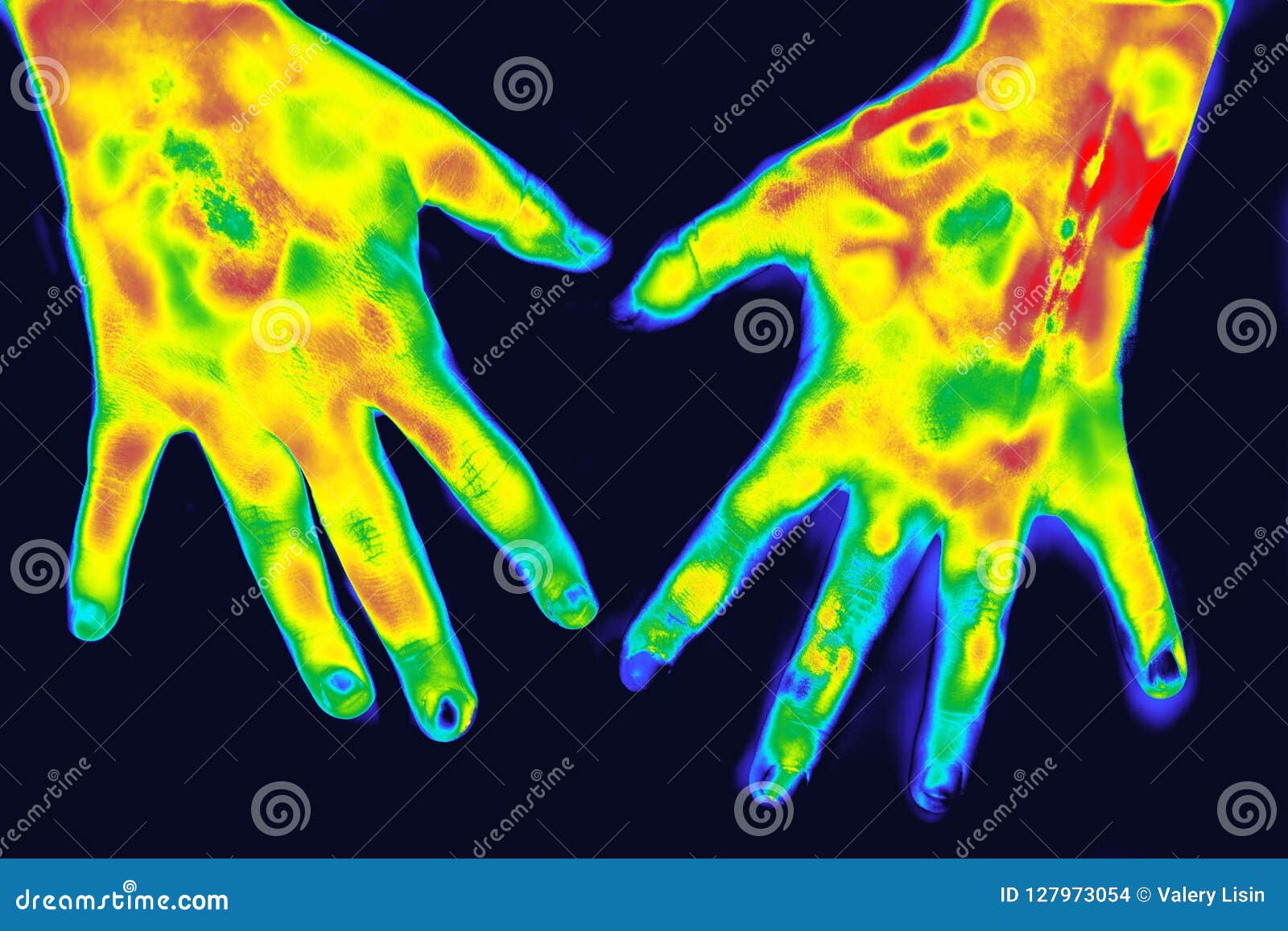 Thermographie in Der Medizin Stockfoto - Bild von kamera, anatomie ...