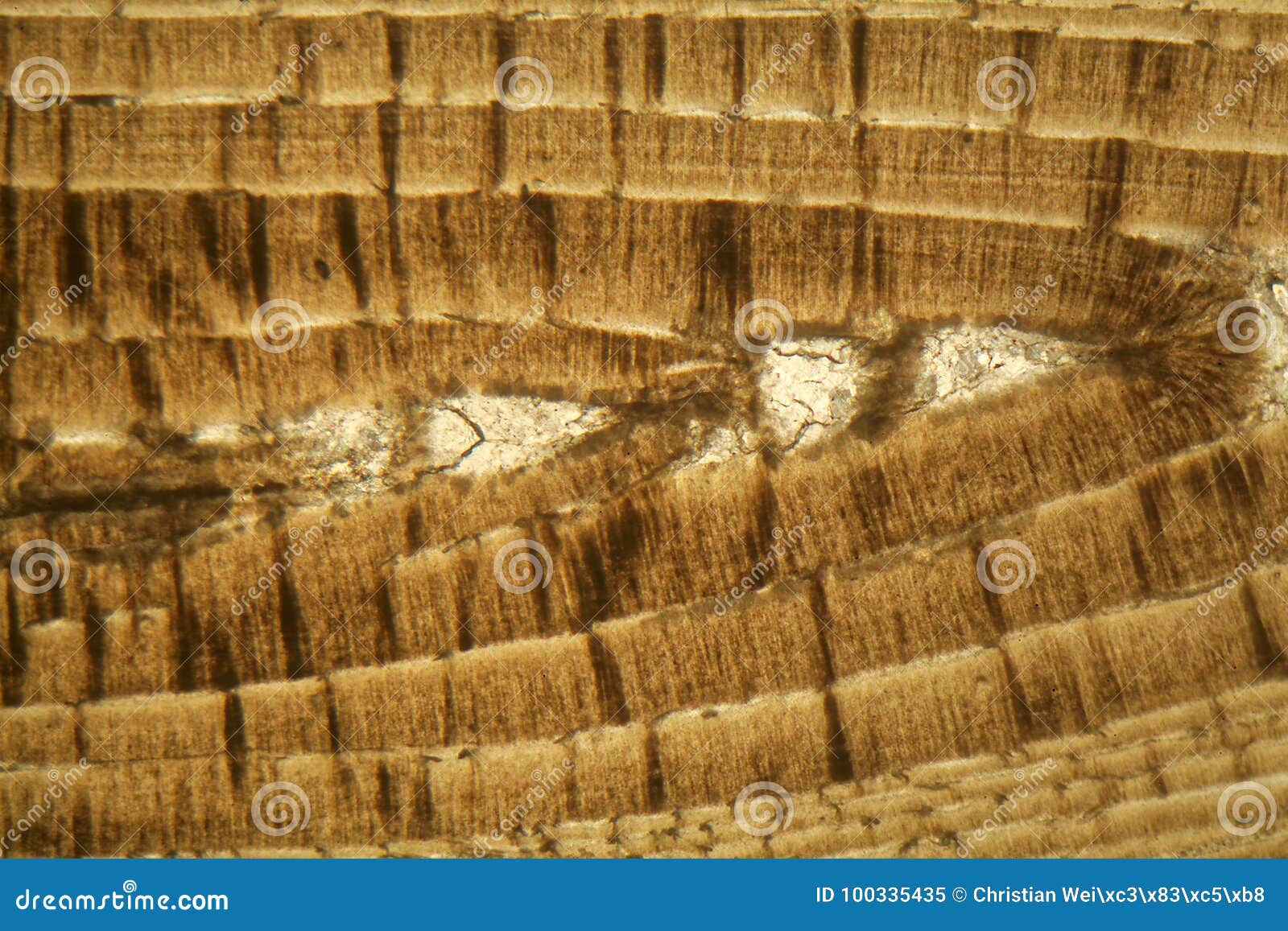 Thin Section of Nummulite Limestone Under the Microscope Stock Image ...