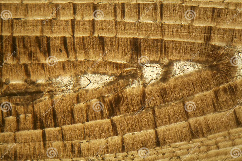 Thin Section of Nummulite Limestone Under the Microscope Stock Image ...