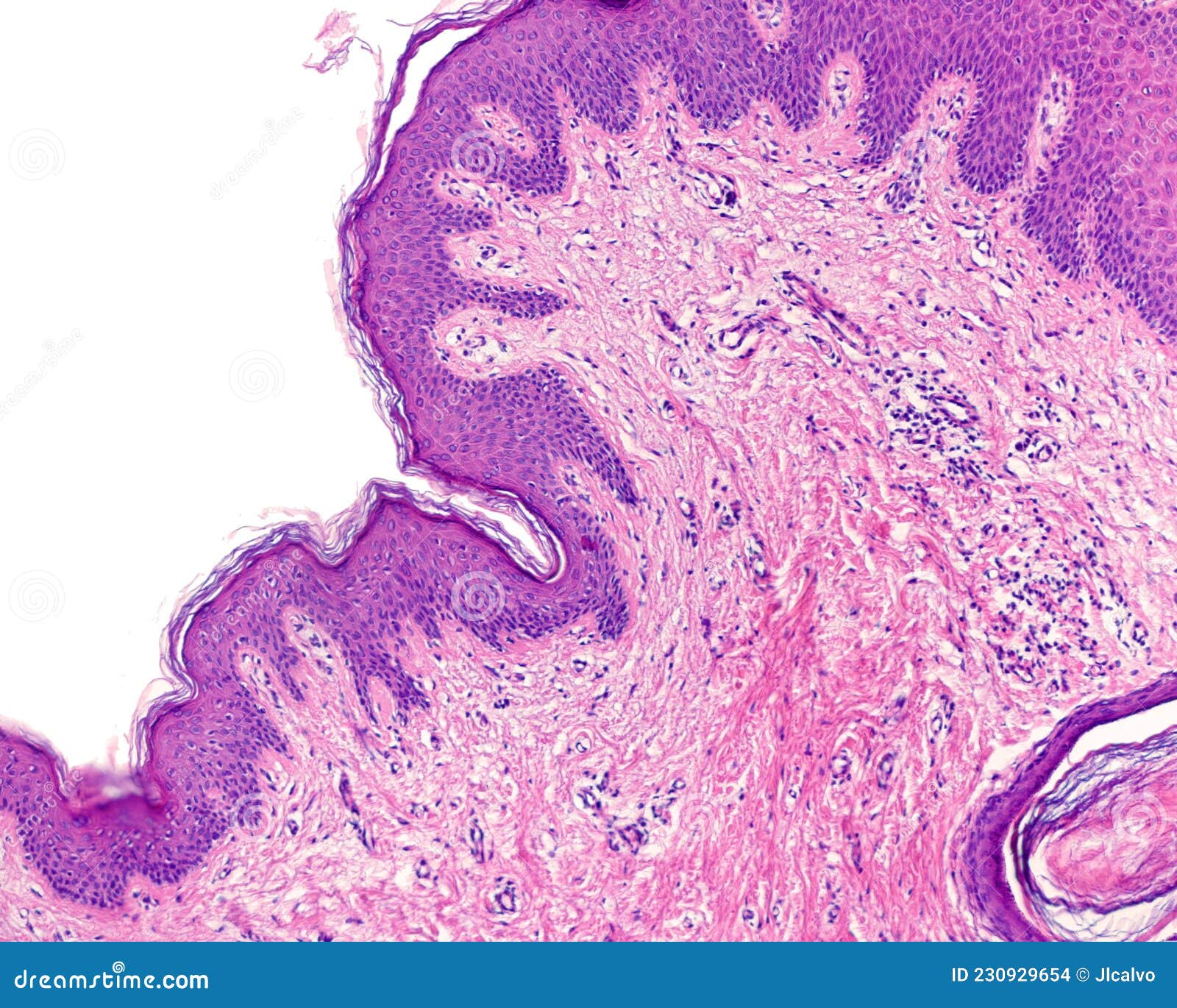Thin skin stock photo. Image of epidermis, cell, cytological - 230929654