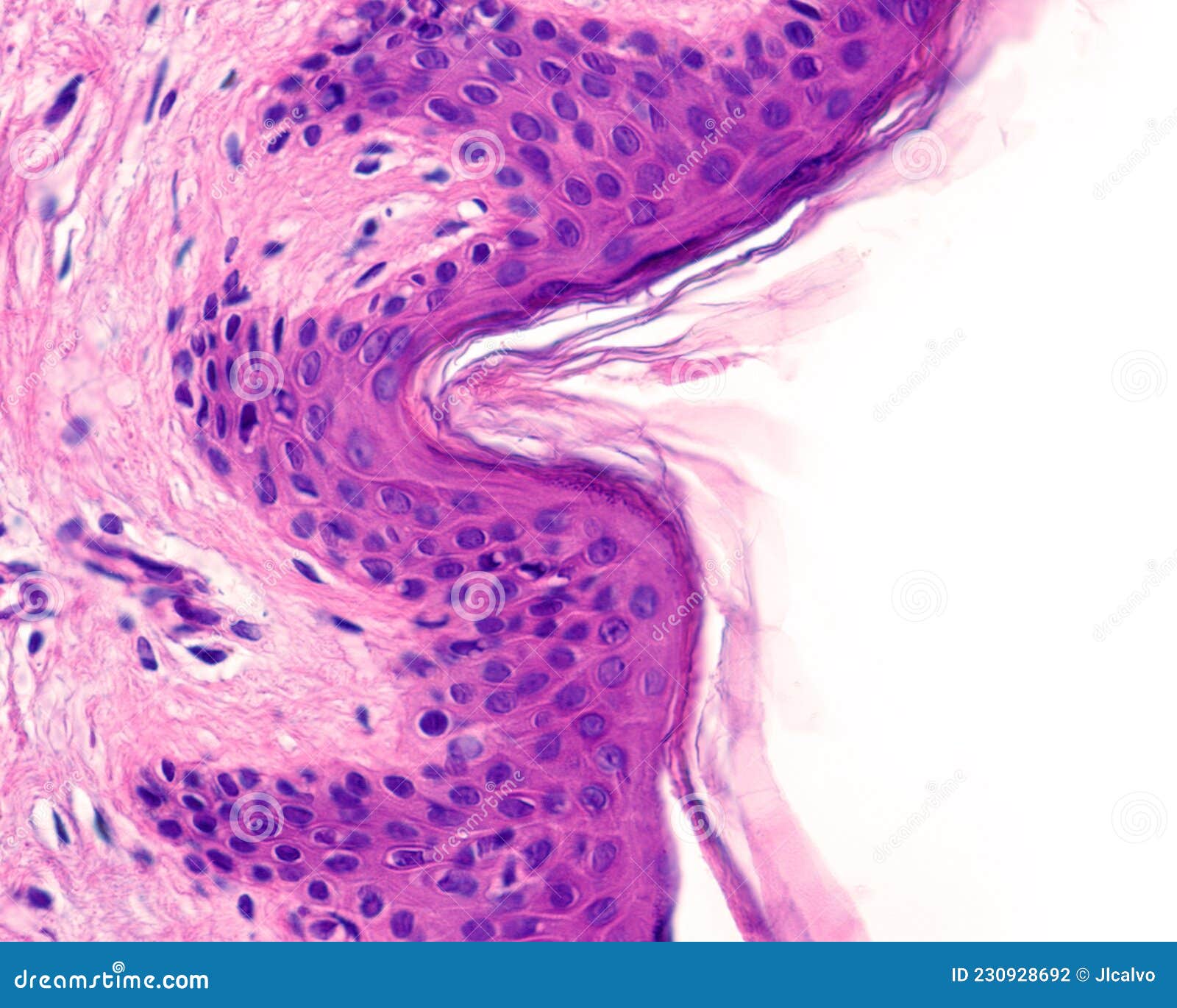 Human thin skin stock photo. Image of histology, human - 230928692