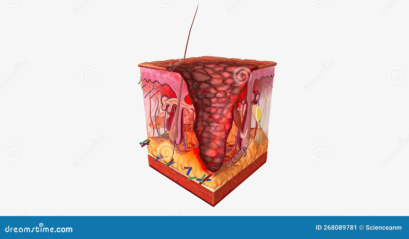 A Third Degree Burn Will Damage All of the Layers of the Skin: the ...